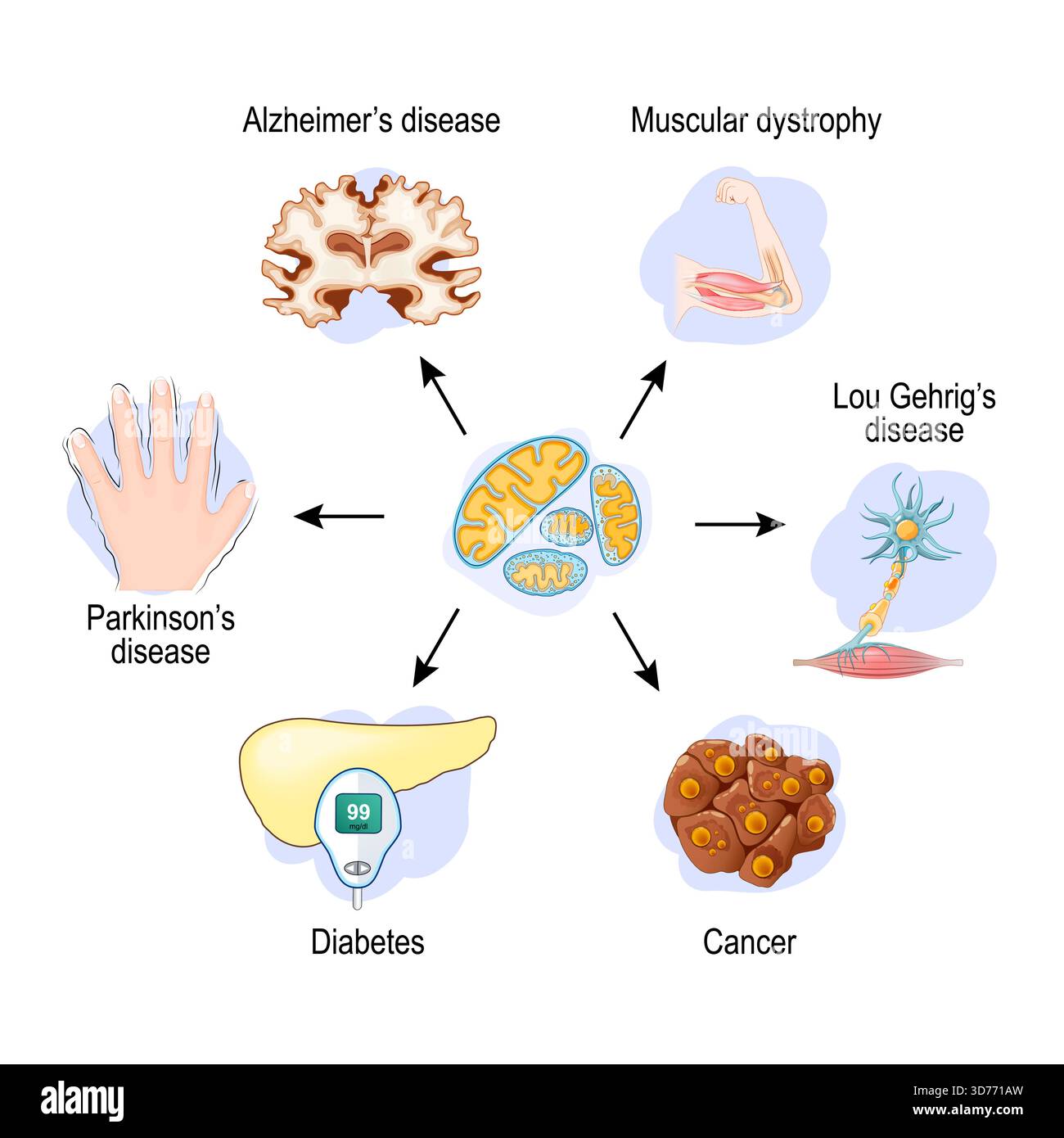 Diseases are associated with mitochondrial dysfunction. Vector ...
