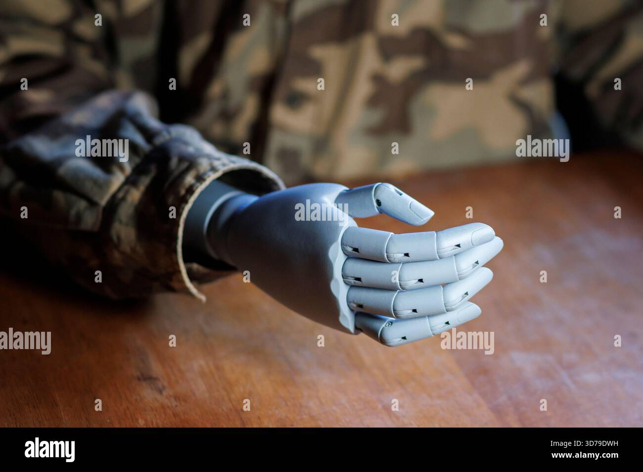Military veteran showing prosthetic hi-res stock photography and images ...