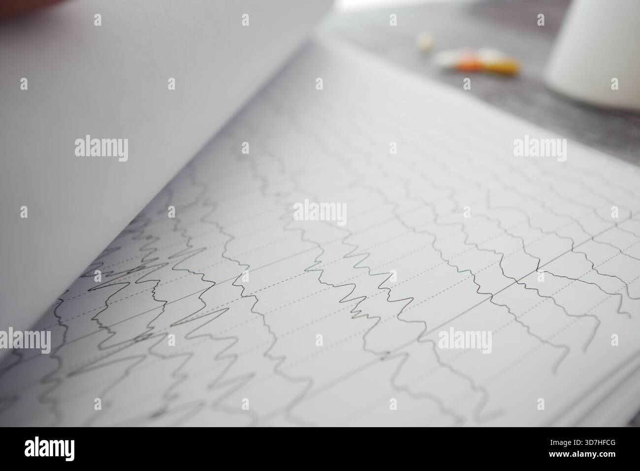 Eeg brain waves paper hi-res stock photography and images - Alamy