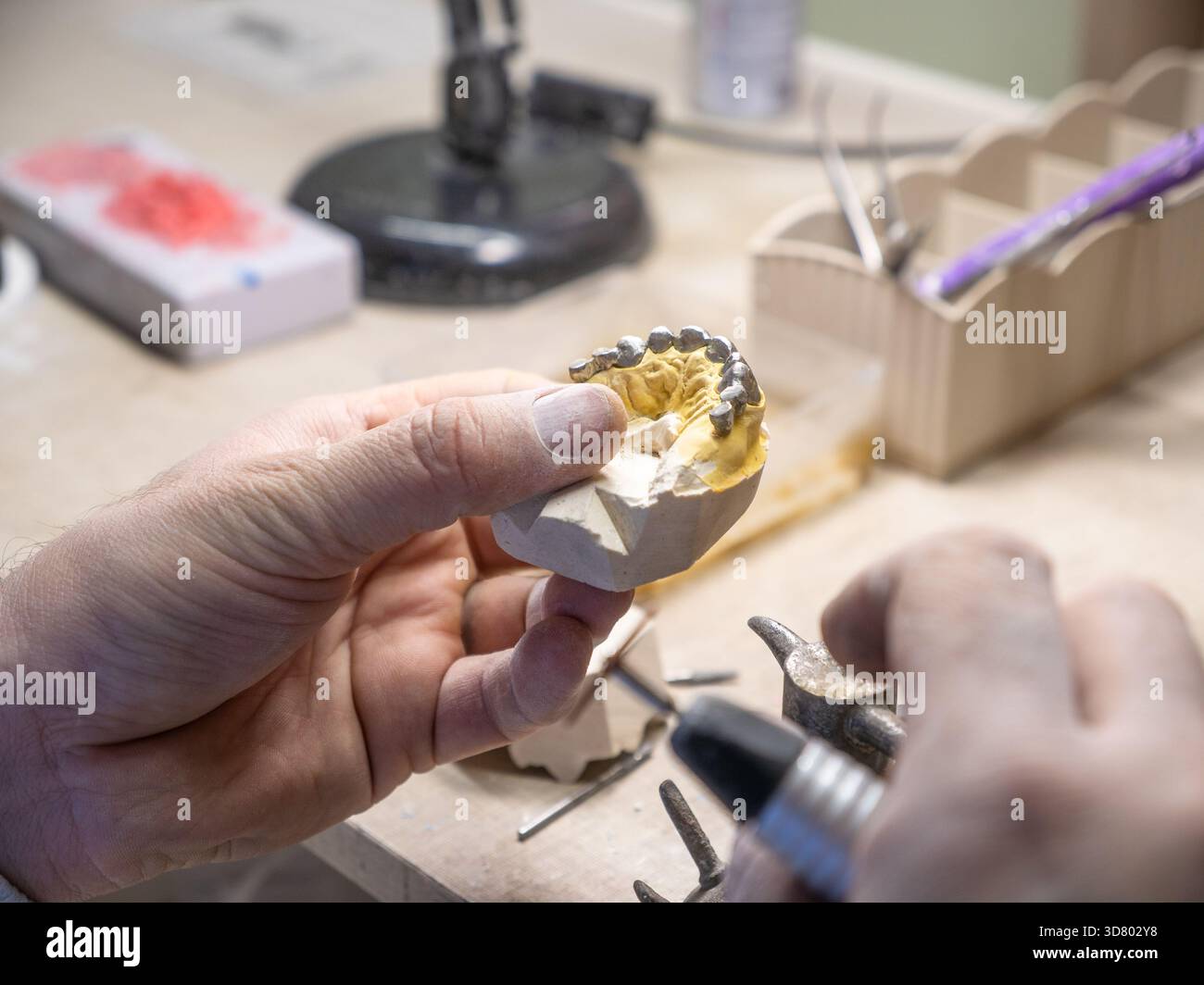 Metal dental bridge fitting on gypsum model in dental laboratory ...