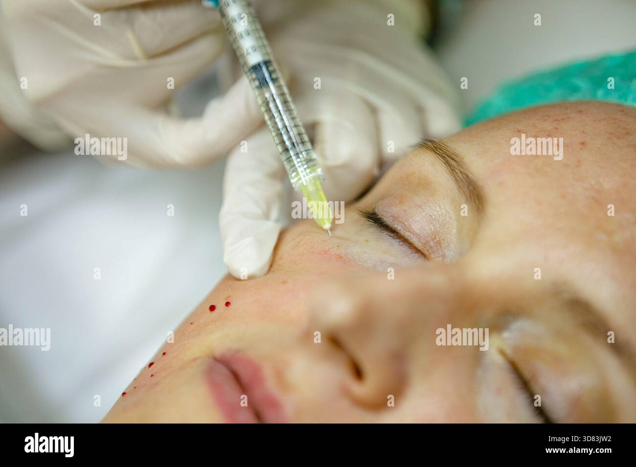 Injection procedures hi-res stock photography and images - Alamy