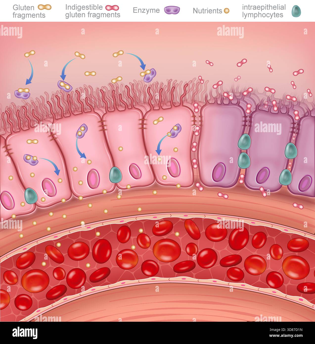 Celiac condition hi-res stock photography and images - Alamy