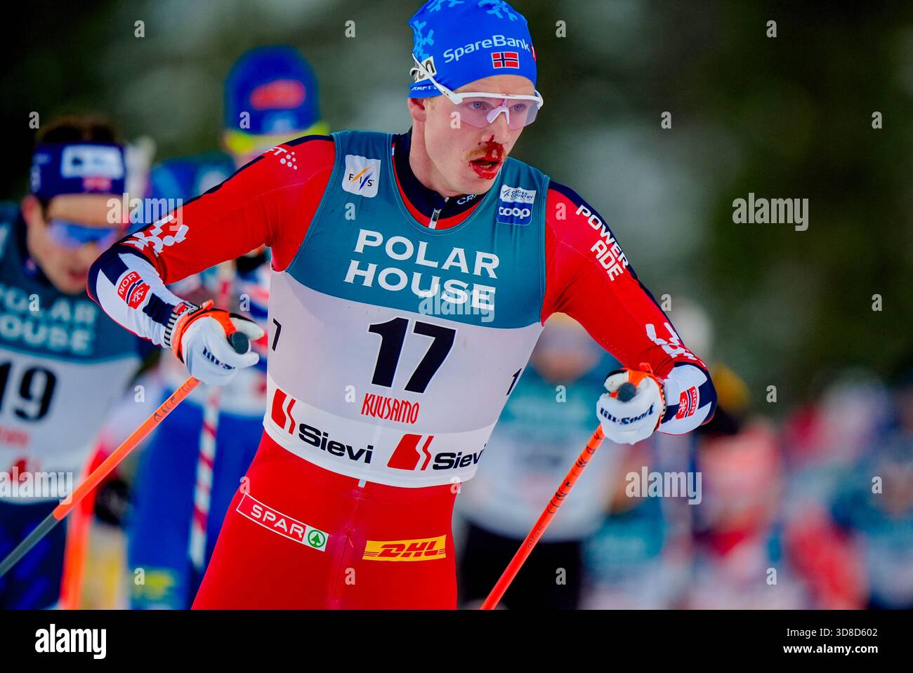 Ruka, Finland 20251130. Jan Thomas Jenssen with a bloody nose during ...