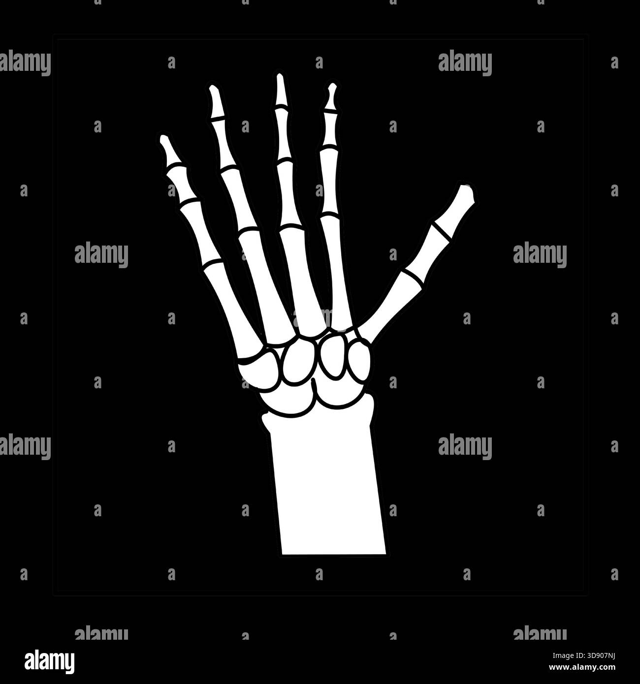 hand finger bones xray carpal bones radiology medical icon black ground ...