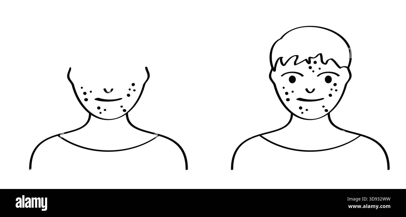 Acne on face. Skincare, dermatology examination concept silhouette ...
