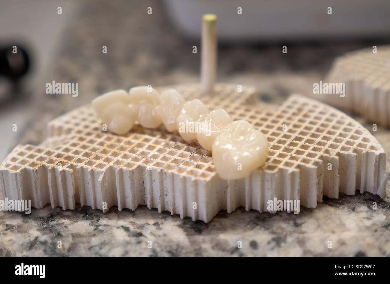 Ceramic dental bridge on refractory base in dental lab for prosthetics ...