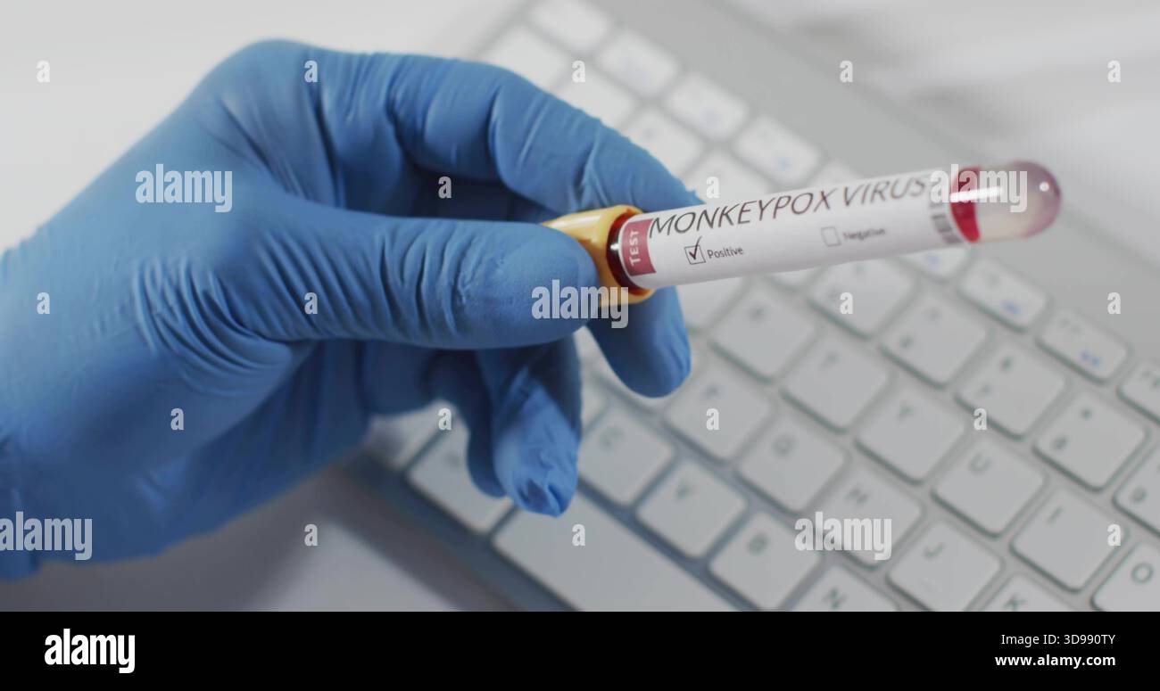 Grasping blue nitrile-gloved hand holding blood tube with yellow cap ...