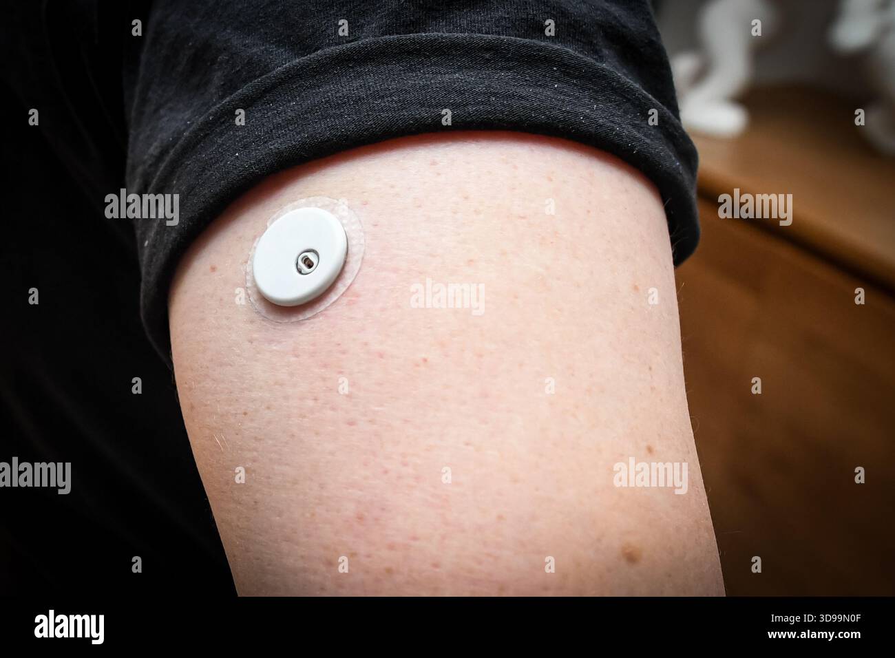 Illustration picture shows the Abbott Freestyle Libre 3 Plus glucose ...