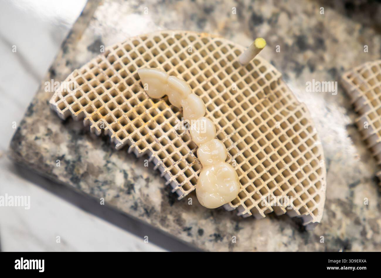 Ceramic dental crowns on refractory base in dental lab for prosthetics ...