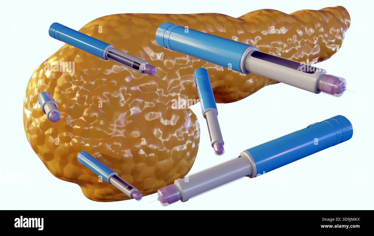 A 3D rendering of the human pancreas and several blue and purple auto ...