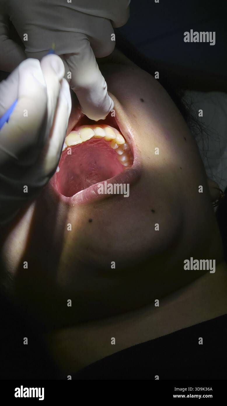 Dentist performs dental checkup hi-res stock photography and images - Alamy