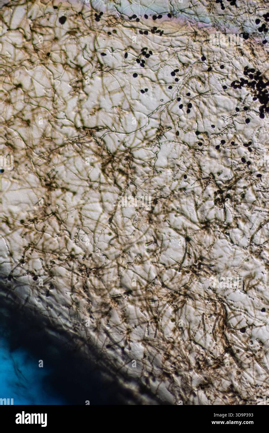 Microsclerotia interwoven hi-res stock photography and images - Alamy