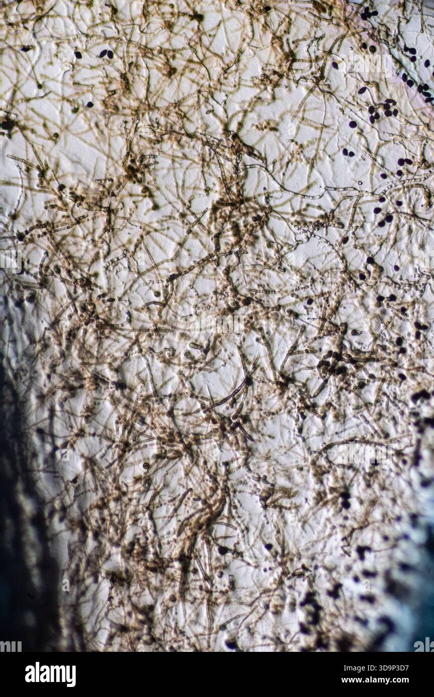 Microsclerotia interwoven hi-res stock photography and images - Alamy