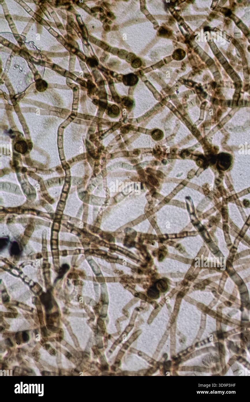 Chlamydospore hi-res stock photography and images - Alamy