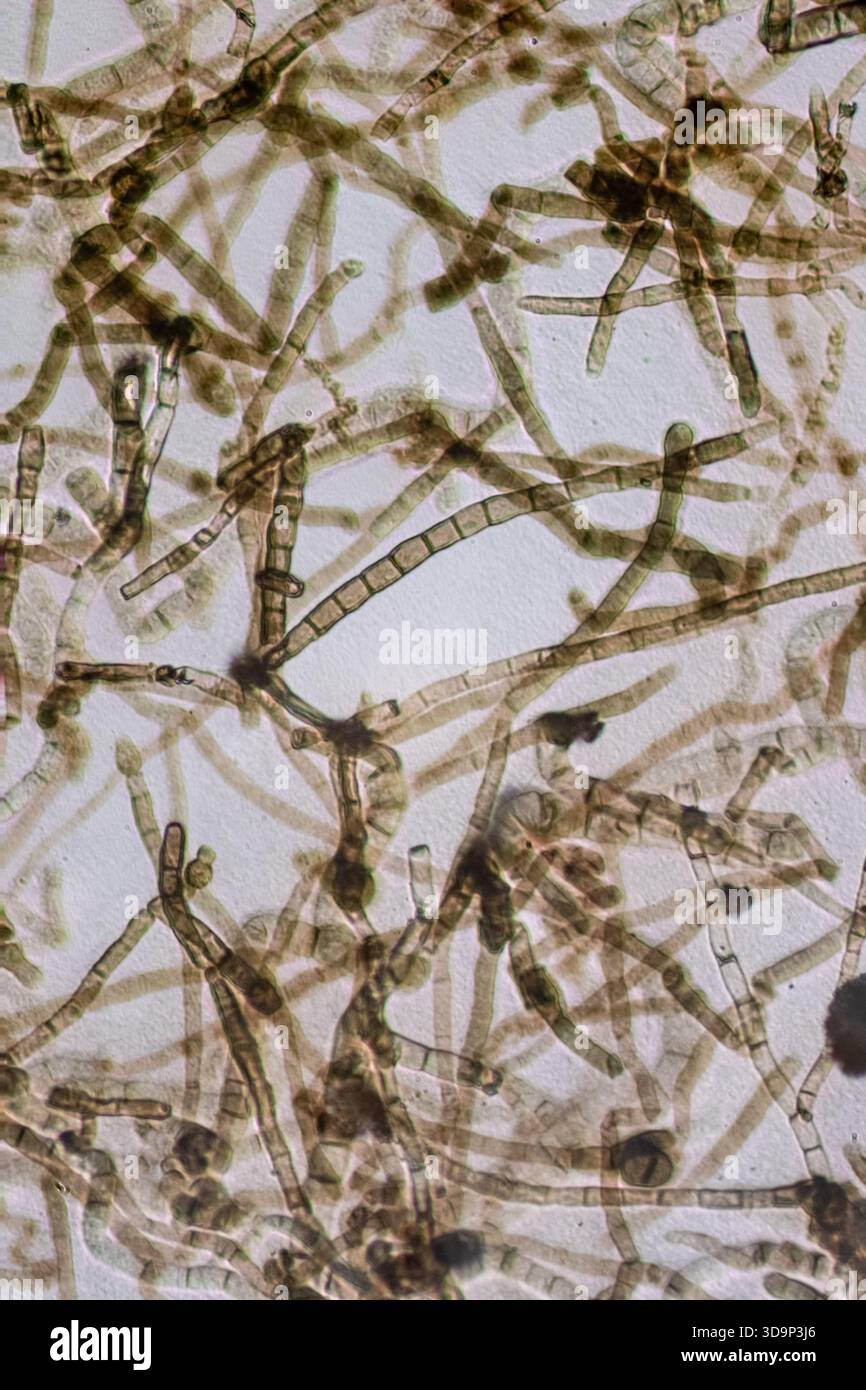 Microsclerotia interwoven hi-res stock photography and images - Alamy