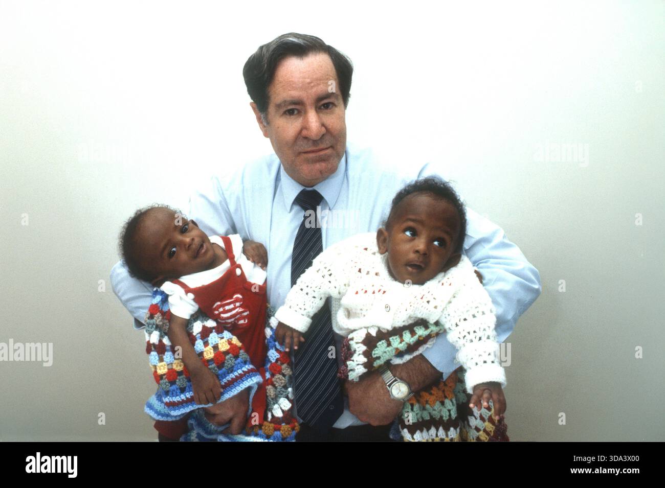 Hussein and hassan conjoined hi-res stock photography and images - Alamy