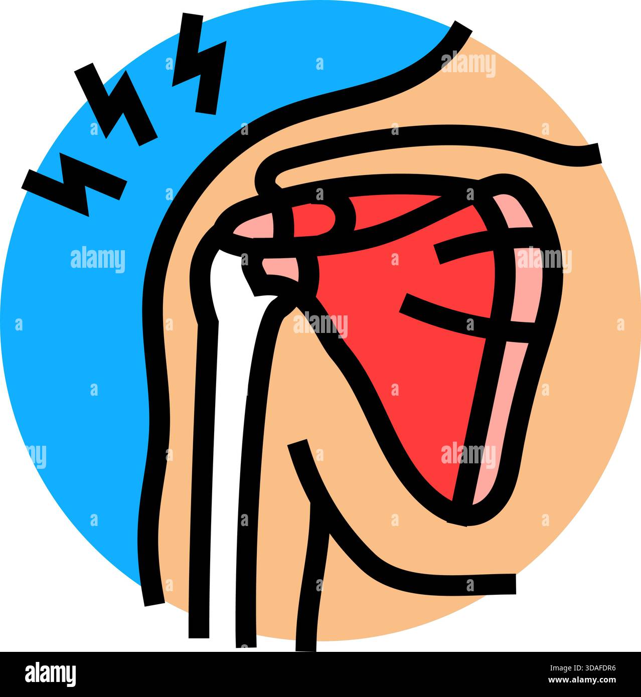 rotator cuff injury diagram color icon vector illustration Stock Vector ...