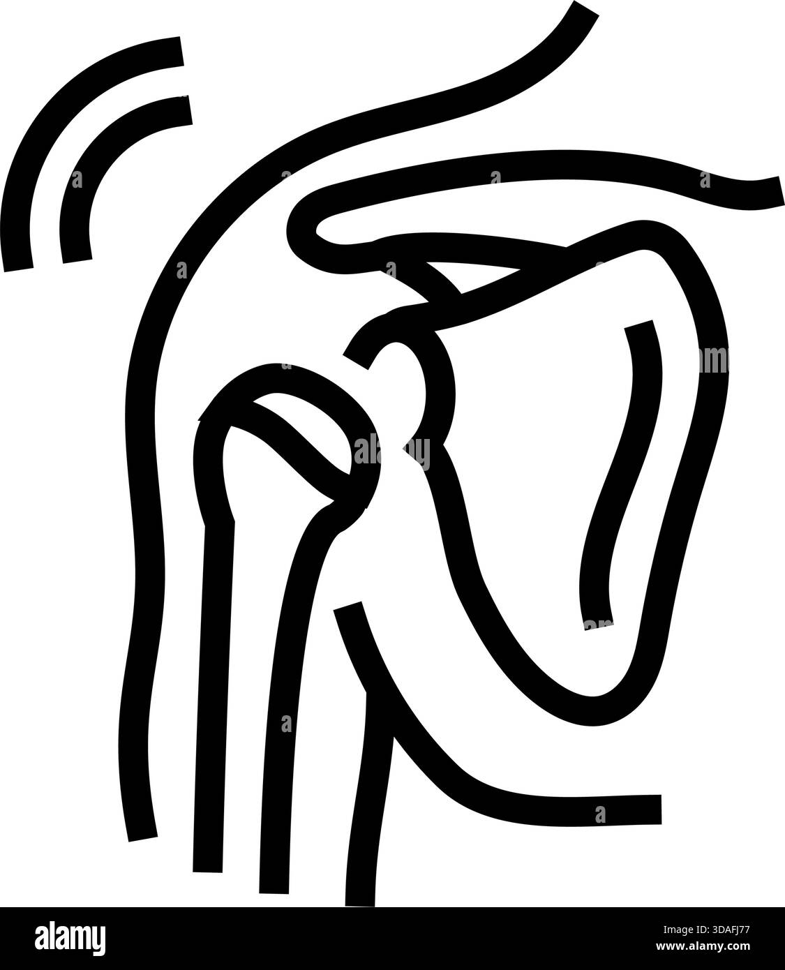 Shoulder sprain Black and White Stock Photos & Images - Alamy