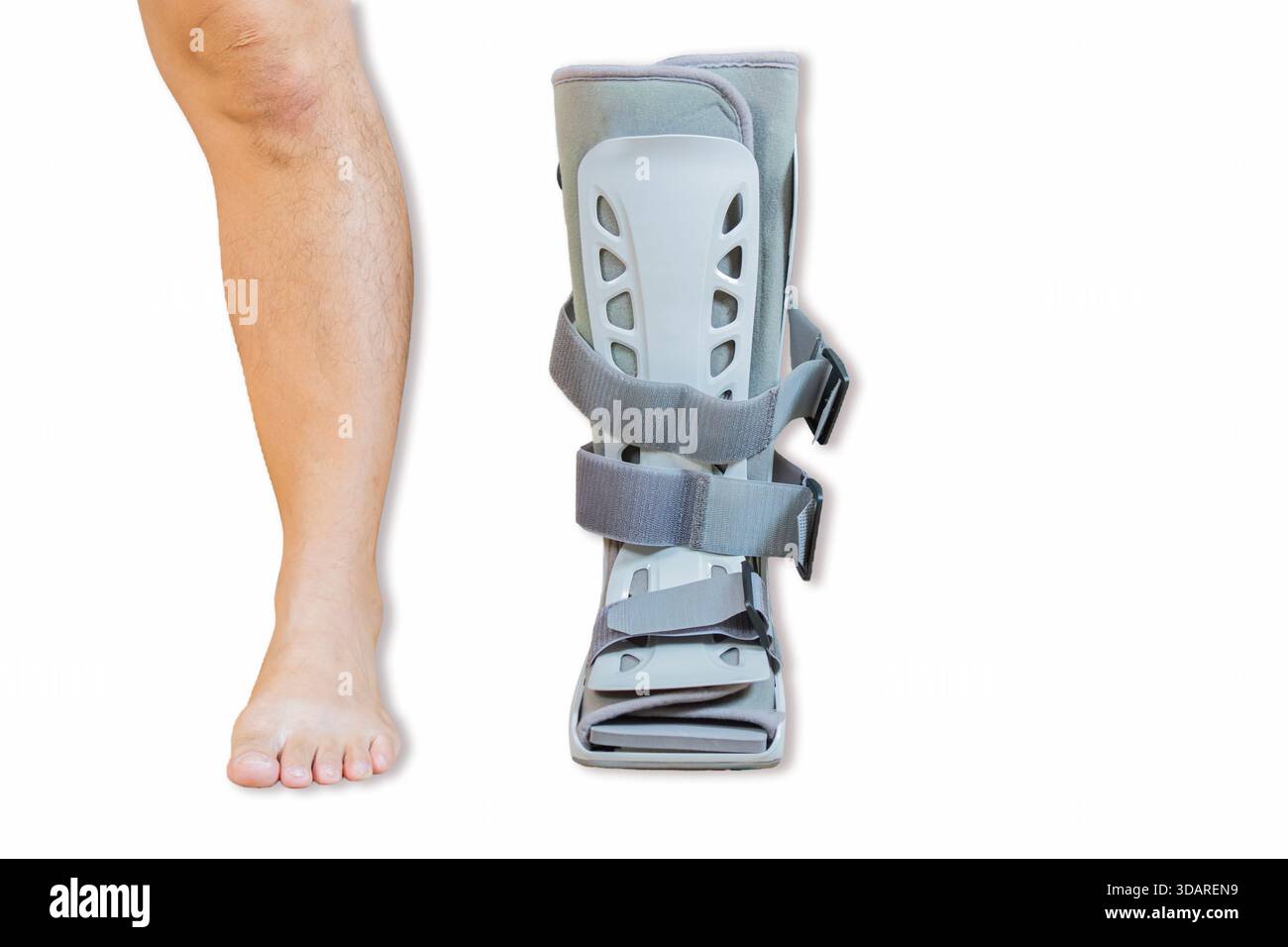 Knee cast Cut Out Stock Images & Pictures - Alamy