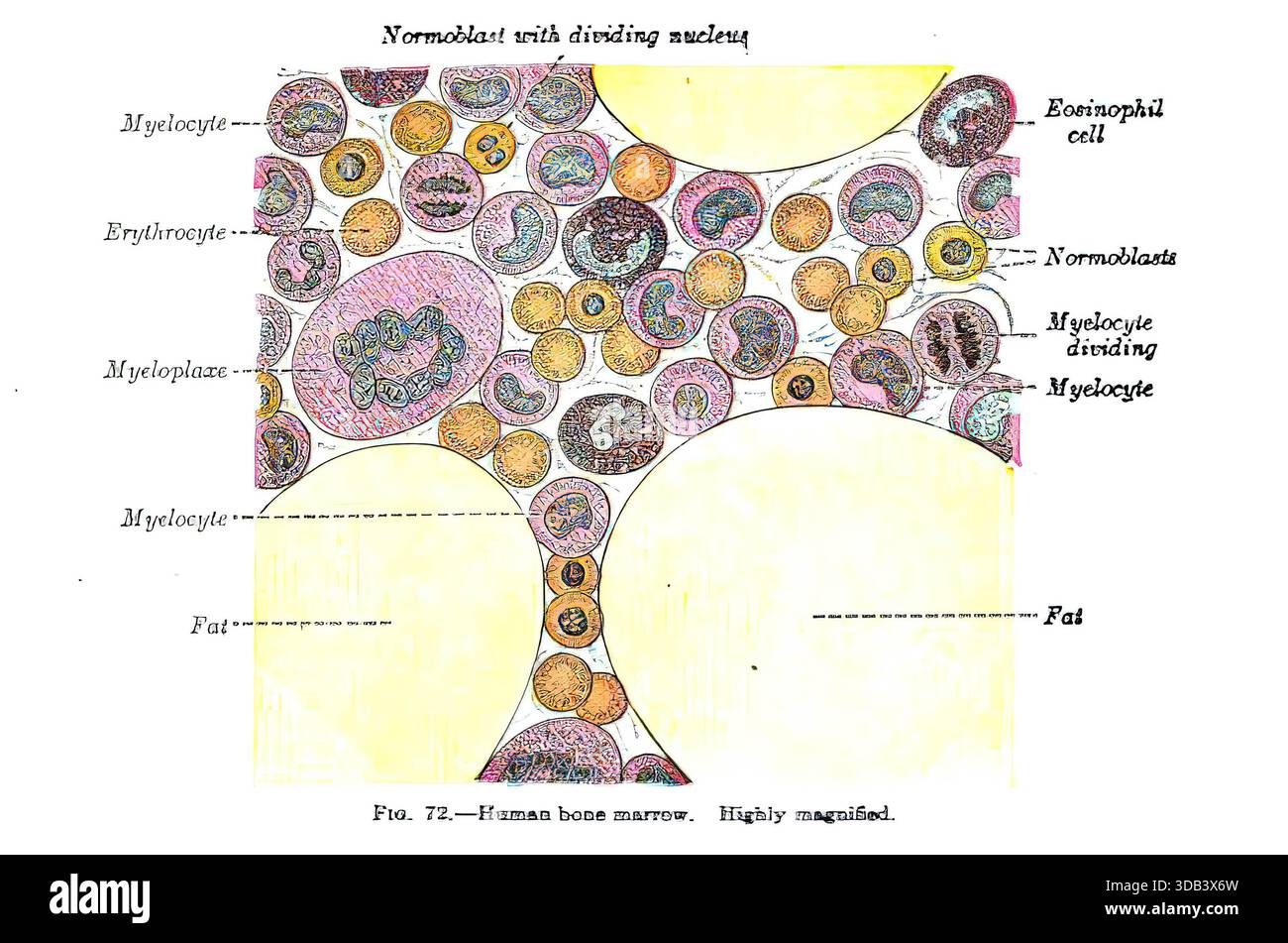 Human bone marrow hi-res stock photography and images - Alamy