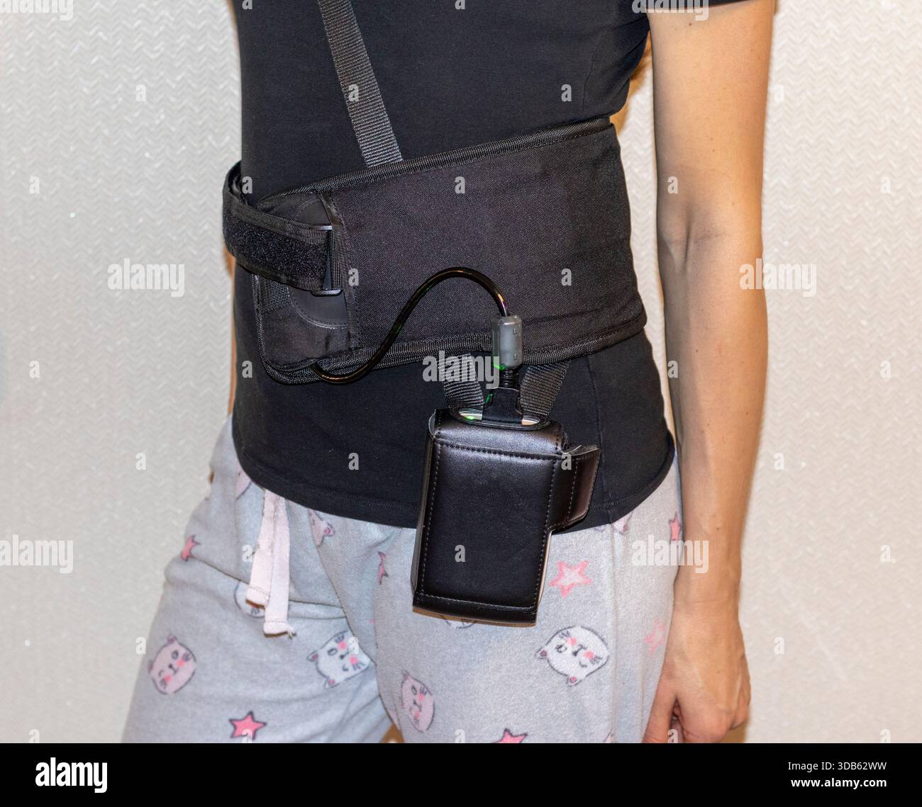 Patient wearing recording device of capsule endoscopy procedure Stock ...