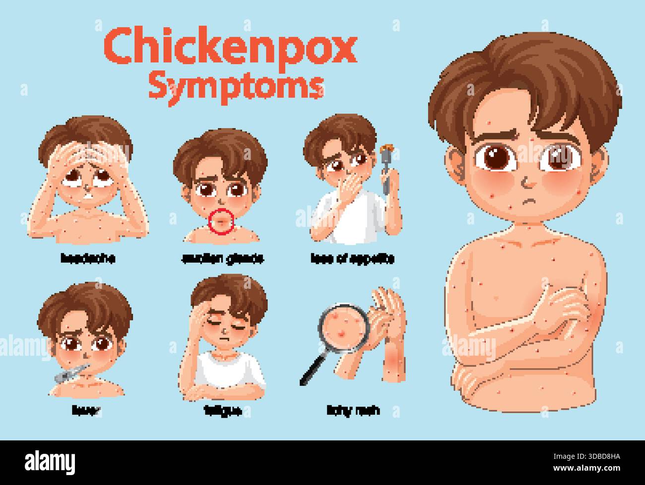 Vector illustration of boy with chickenpox symptoms, flat cartoon style ...