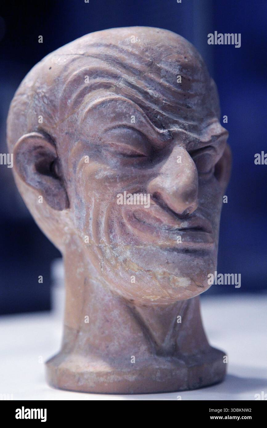 Figurine of a Man with Dwarfism and hydrocephalus.terracotta from ...