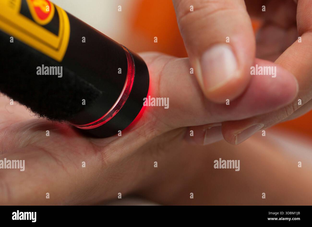 Treatment laser therapy to the articulation of the thumb hi-res stock ...