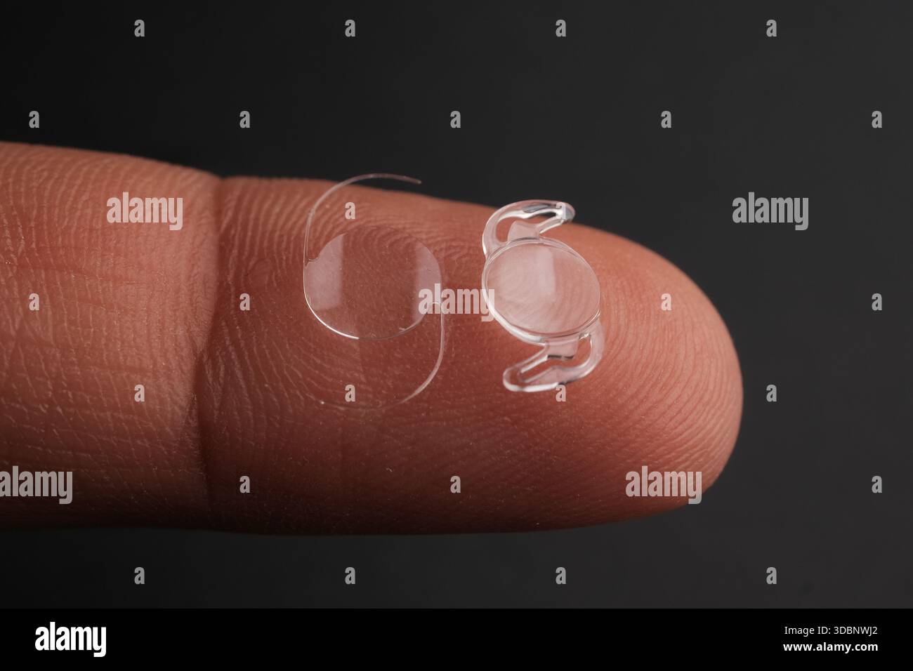 Microscopic View of a Clear, Biocompatible Acrylic Phaco-Foldable ...
