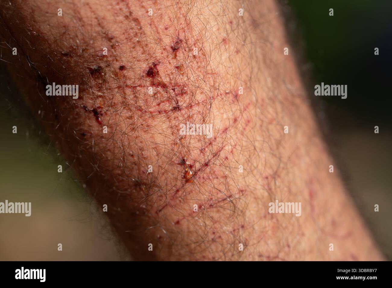 Leg covered in painful scratches. Inflamed skin with bleeding wounds ...