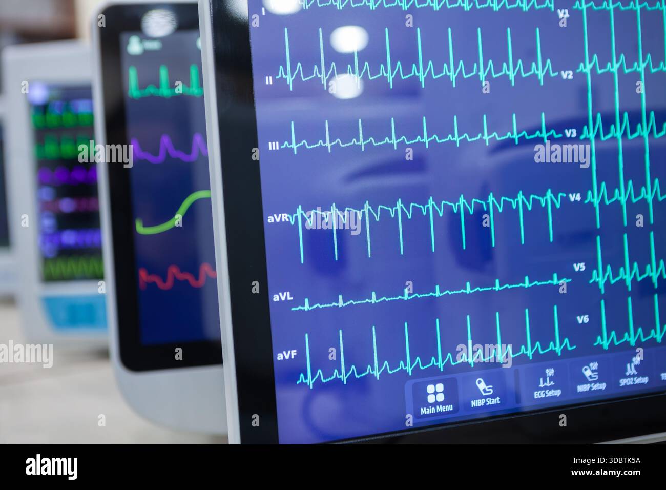 Close-up of medical monitor displaying heart rate and vital signs. A ...