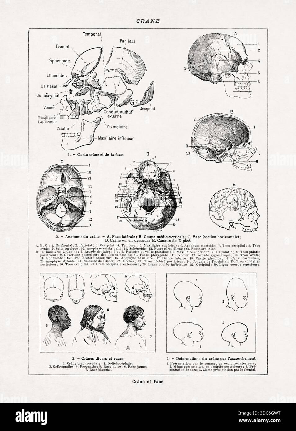 Medical illustration by Jacques Maurice Dessertenne depicting human ...