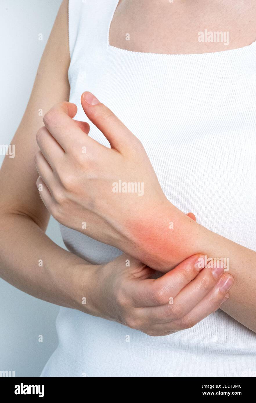Female arm visual pain hi-res stock photography and images - Alamy