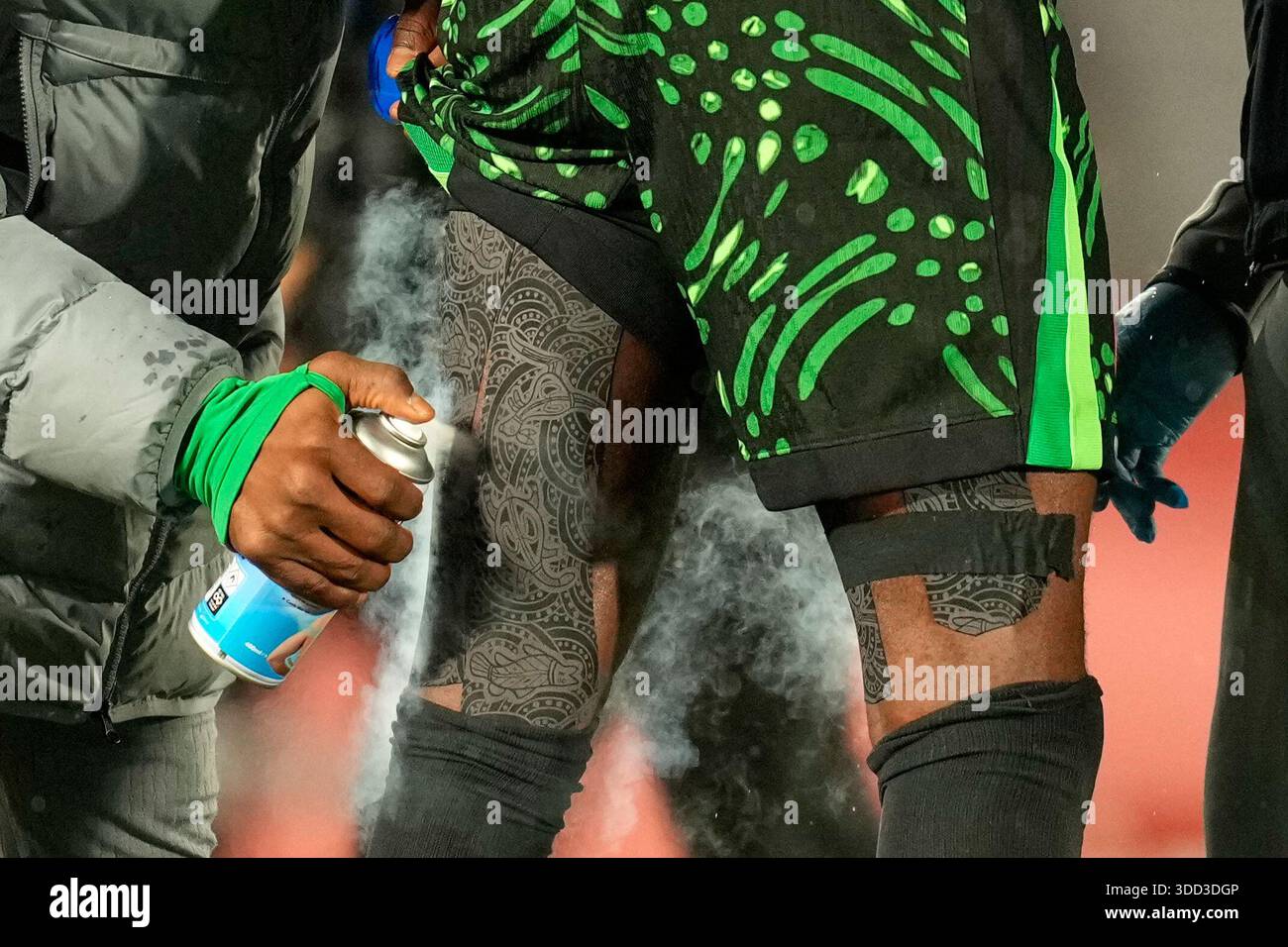 Nigeria's Victor Osimhen receives treatment during the Africa Cup of ...