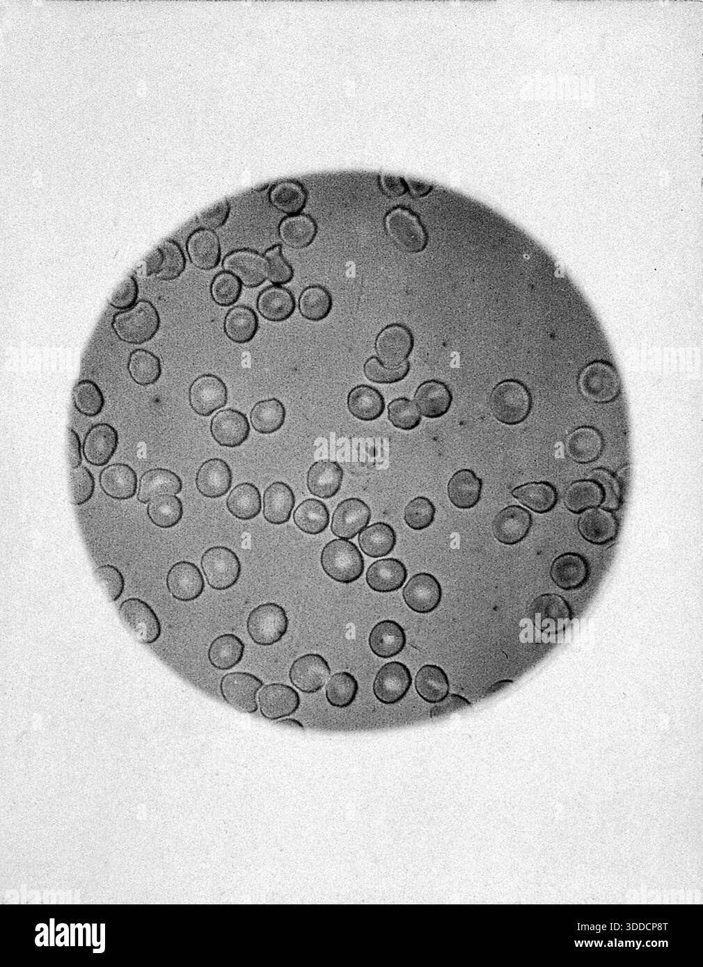 Malarial parasite blood Black and White Stock Photos & Images - Alamy