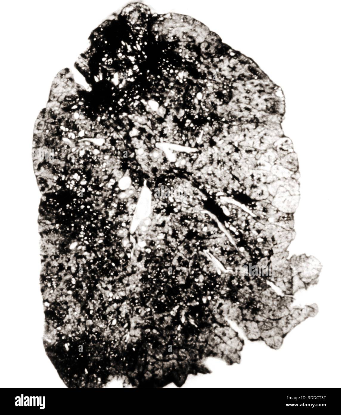 A lung tissue specimen extracted from a coal worker, illustrating the ...