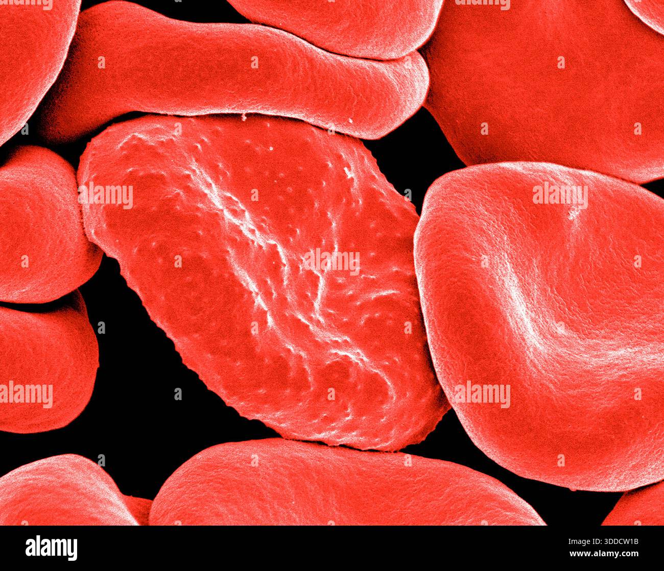 Scanning electron micrograph of red blood cells infected with ...