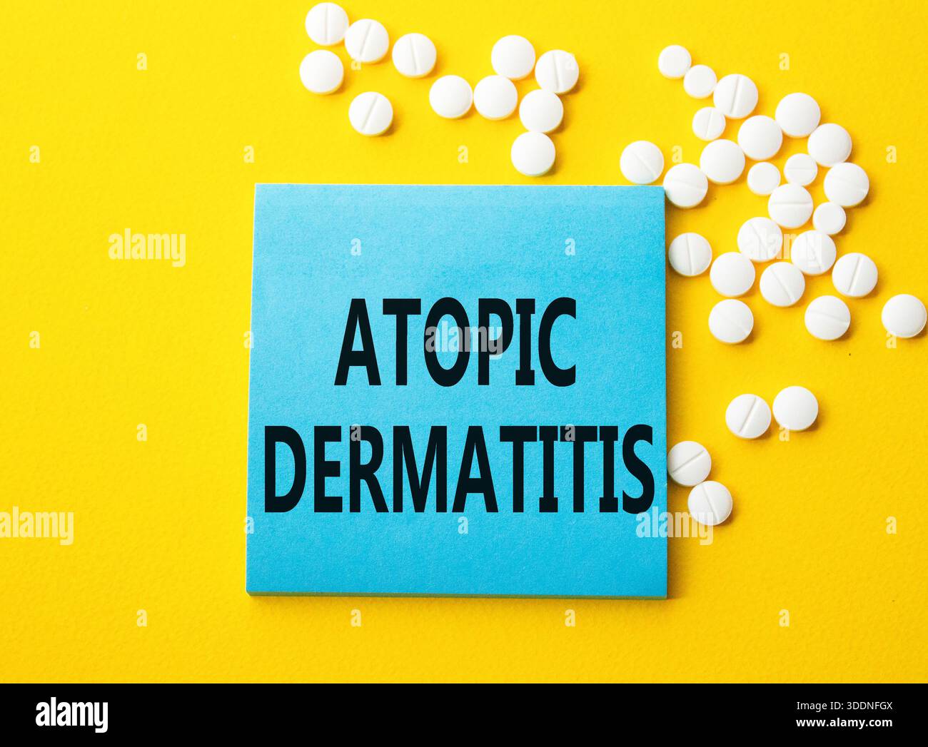 Atopic Dermatitis symbol. Concept word Atopic Dermatitis on blue note ...