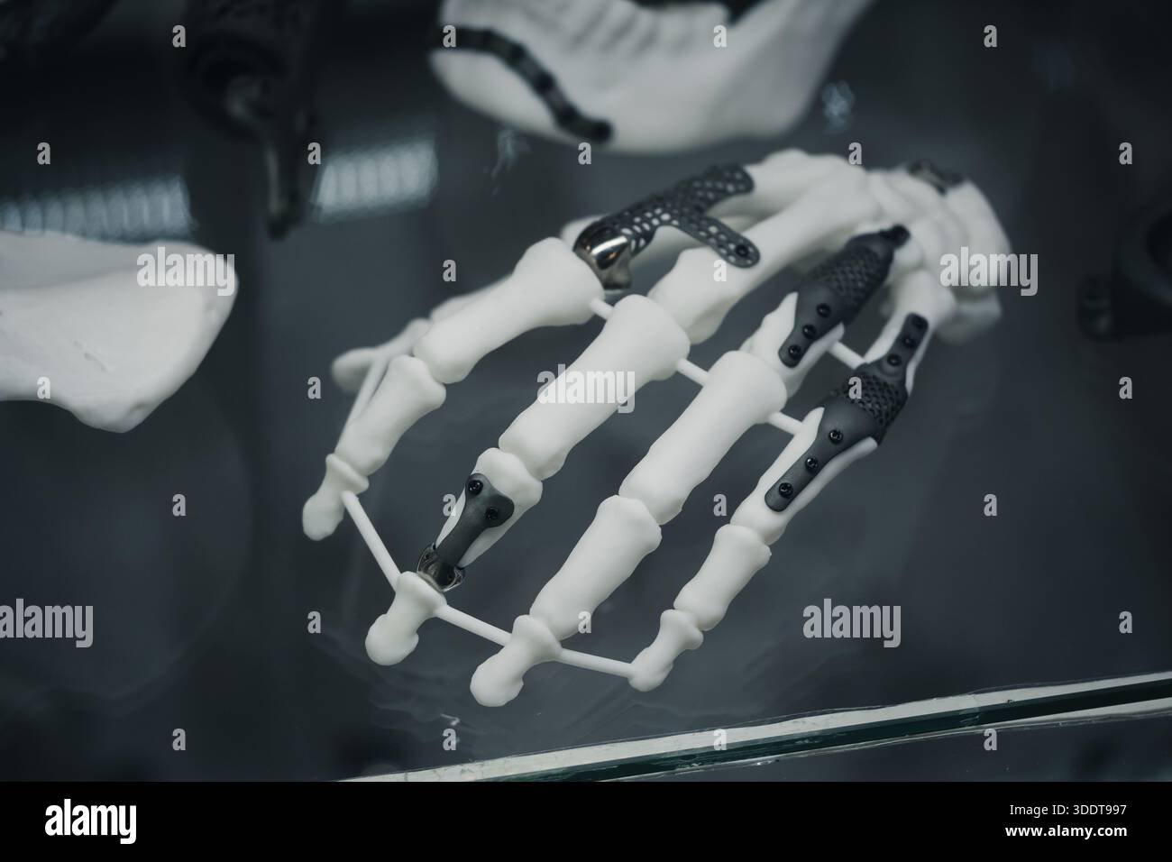 3d printed prosthetic hand hi-res stock photography and images - Alamy