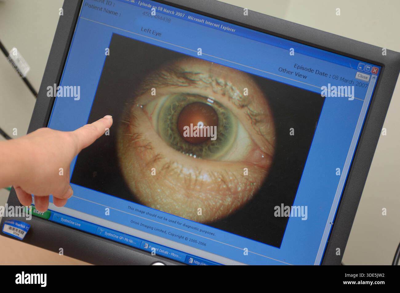 Retinal eye scan ophthalmic hi-res stock photography and images - Alamy