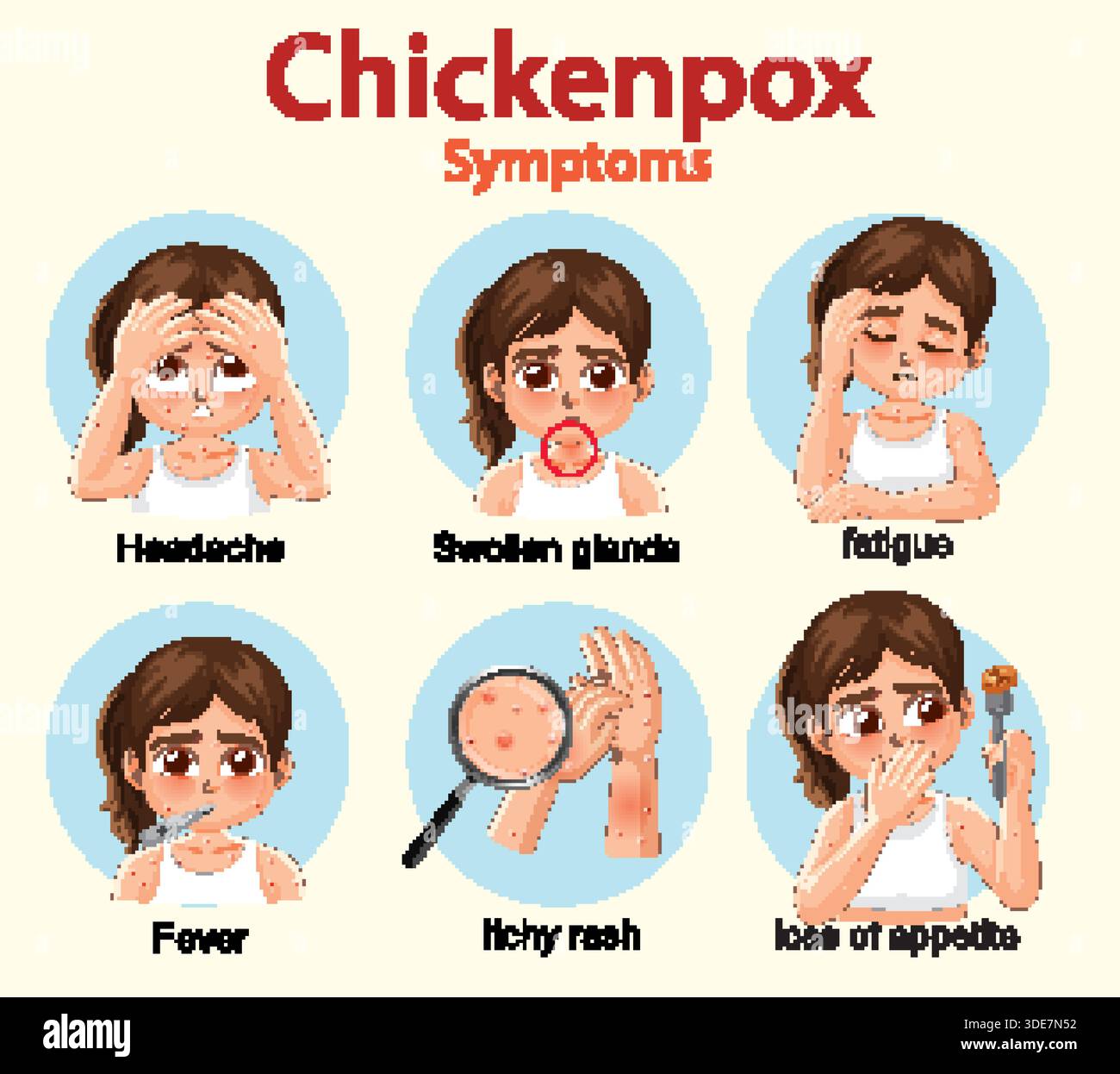 Girl chickenpox spots Stock Vector Images - Alamy