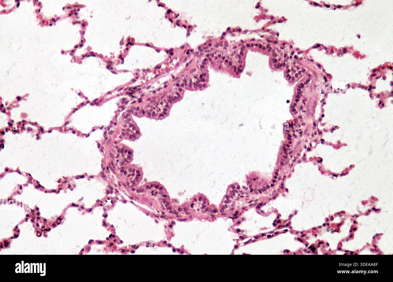 Small bronchiole tube of the human lung, under the microscope Stock ...