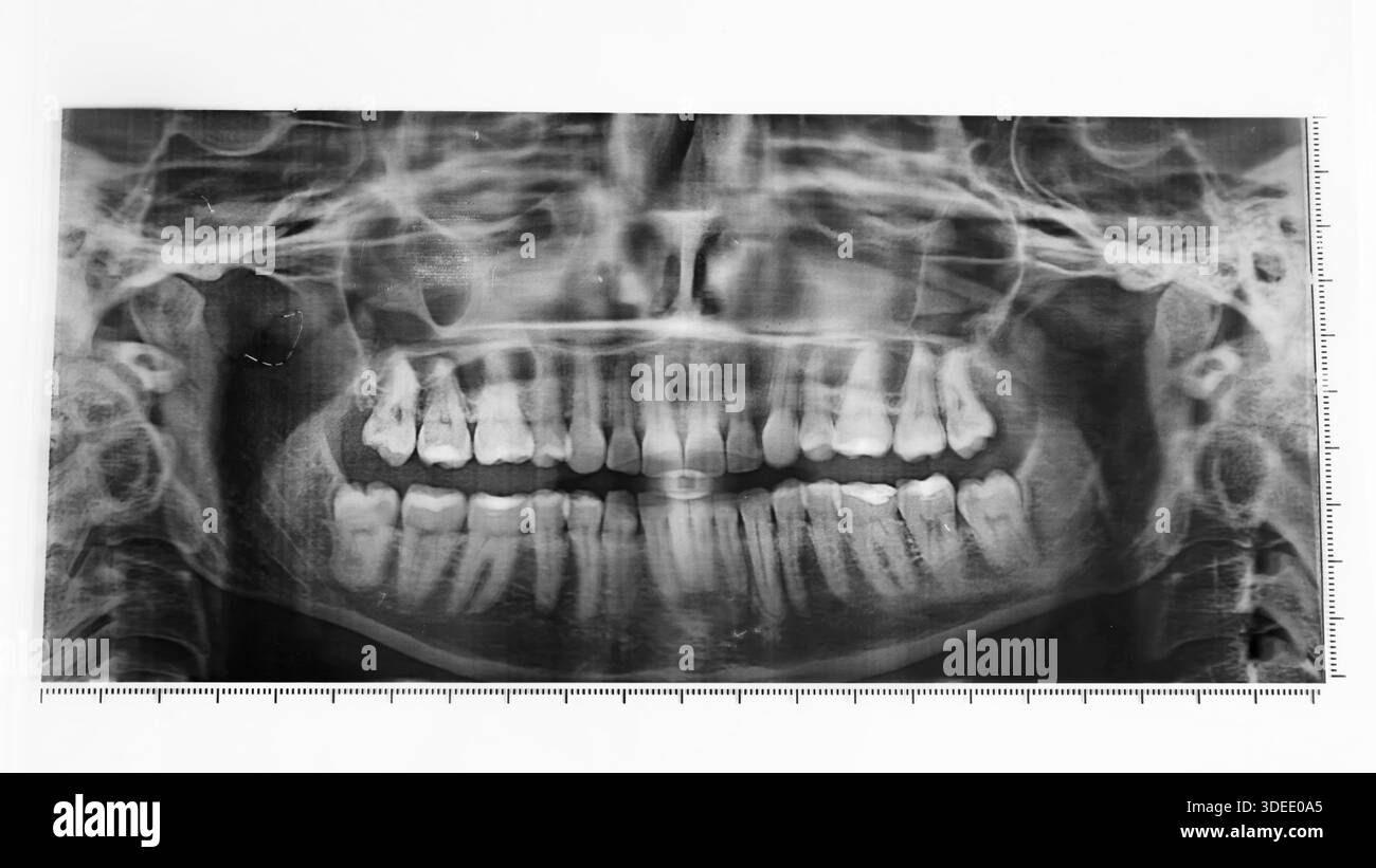 Dental Teeth Scan background Stock Photo - Alamy