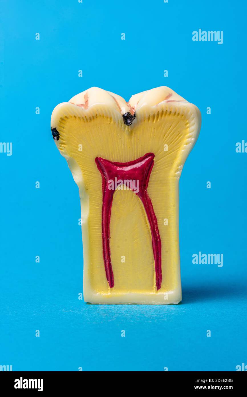 Dental anatomy model illustrating hi-res stock photography and images ...