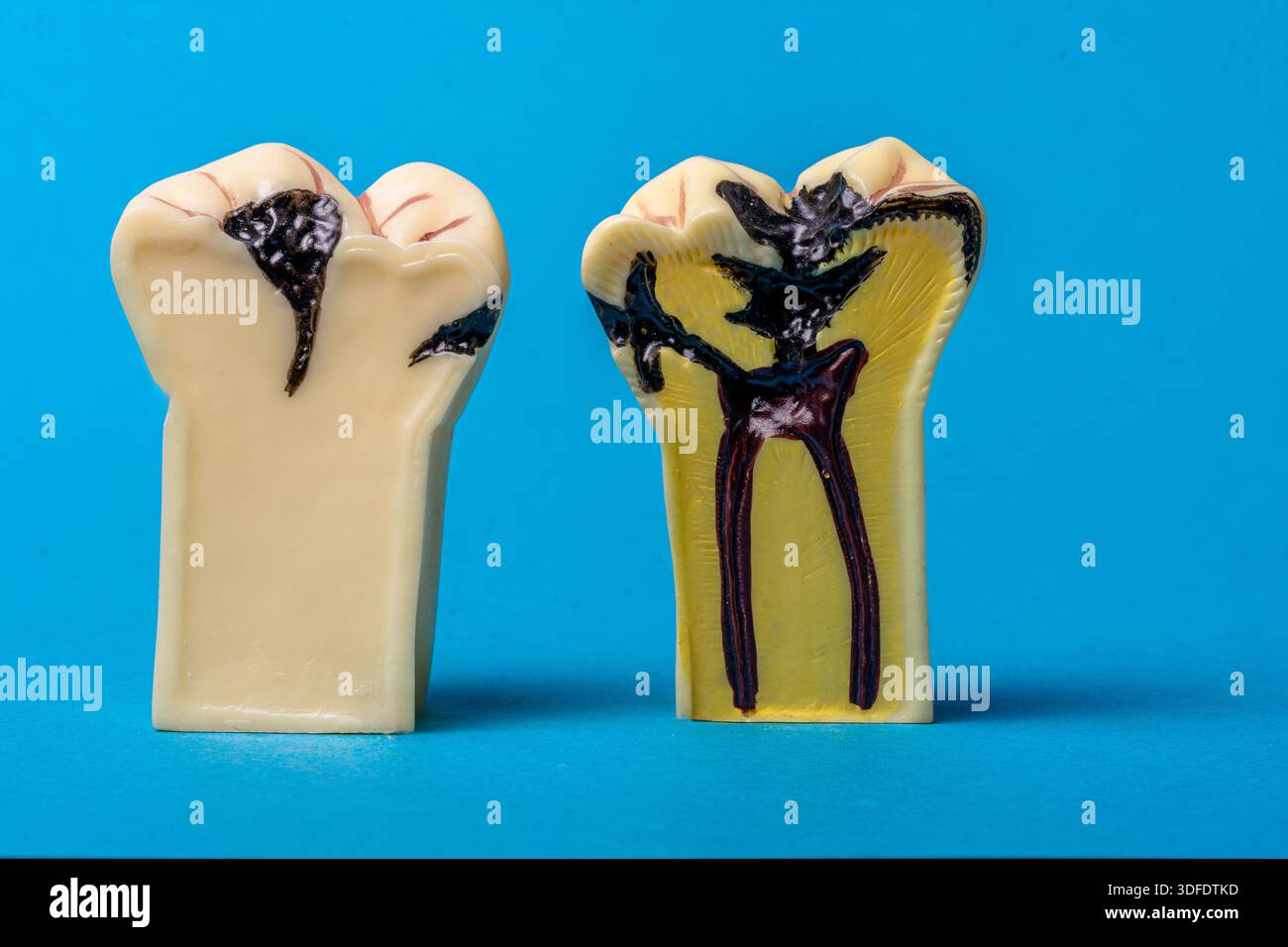 Dental models illustrating human tooth anatomy with external cavity and ...