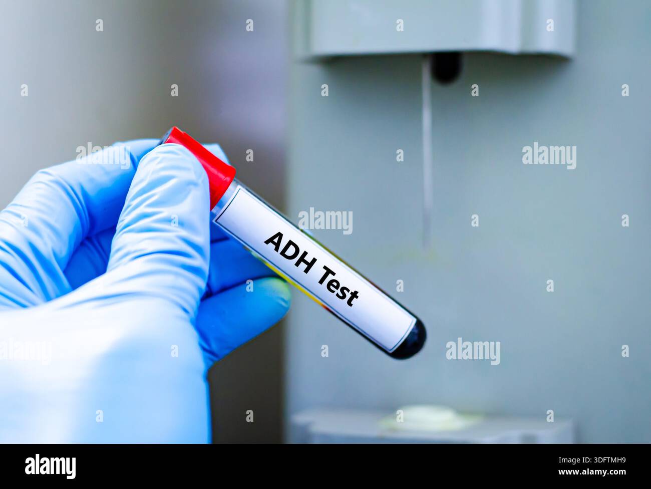 Blood sample tube for anti-diuretic hormone (ADH) test analysis Stock ...