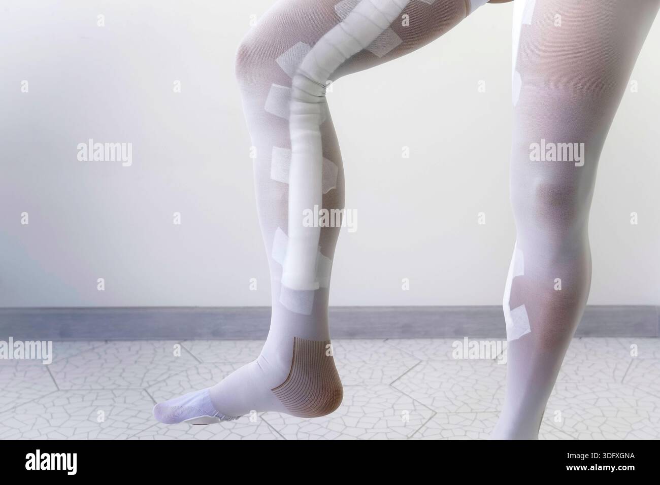 Bandaged man in hospital hi-res stock photography and images - Alamy