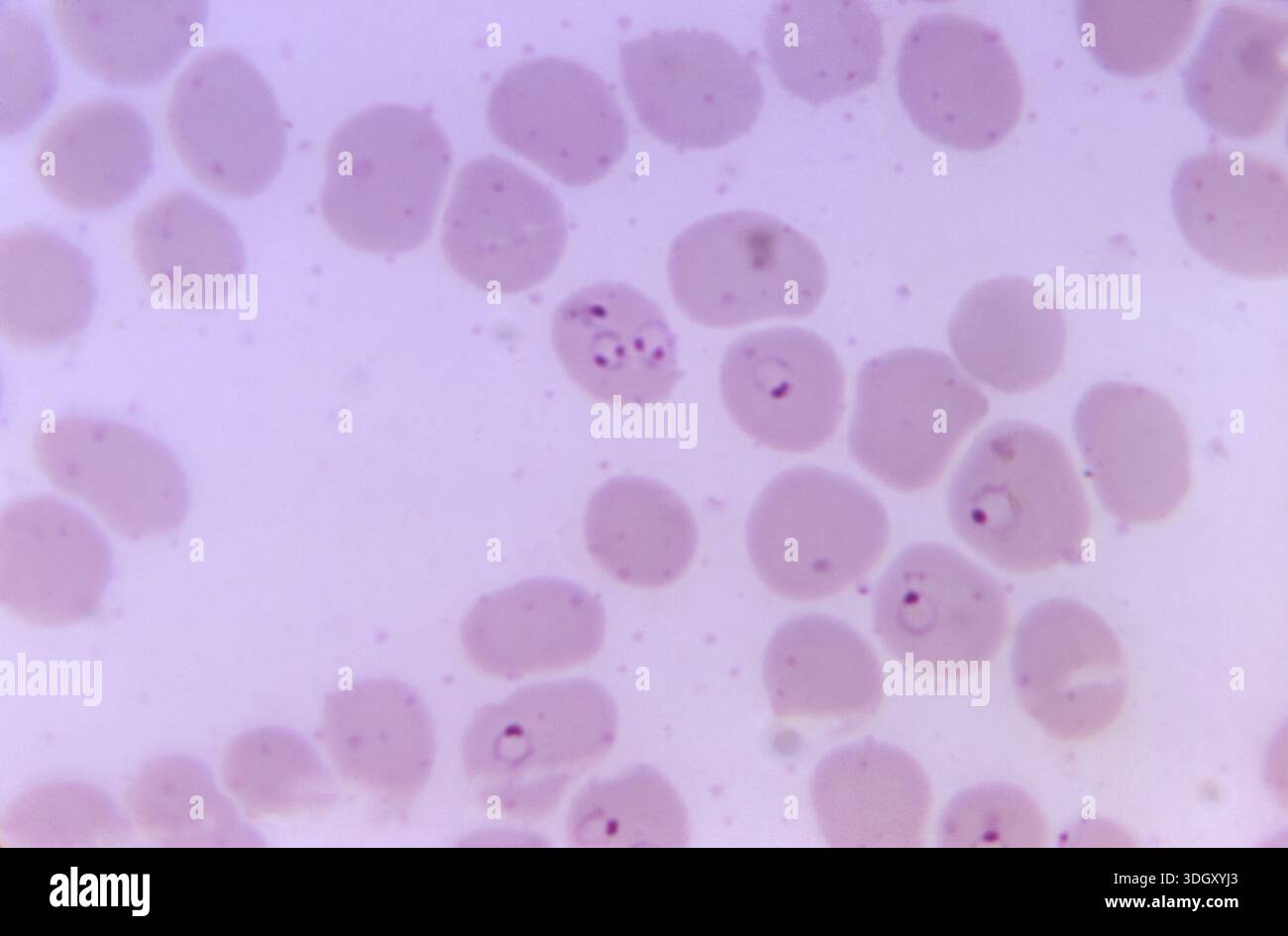Trophozoites in blood smear hi-res stock photography and images - Alamy