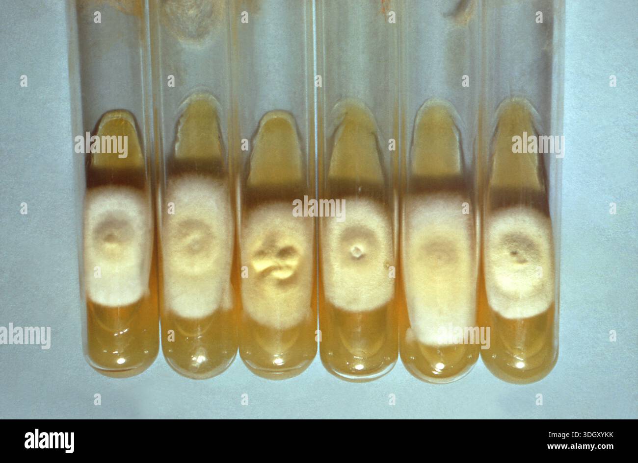 Six test tubes contain growth media inoculated with a downy strain of ...