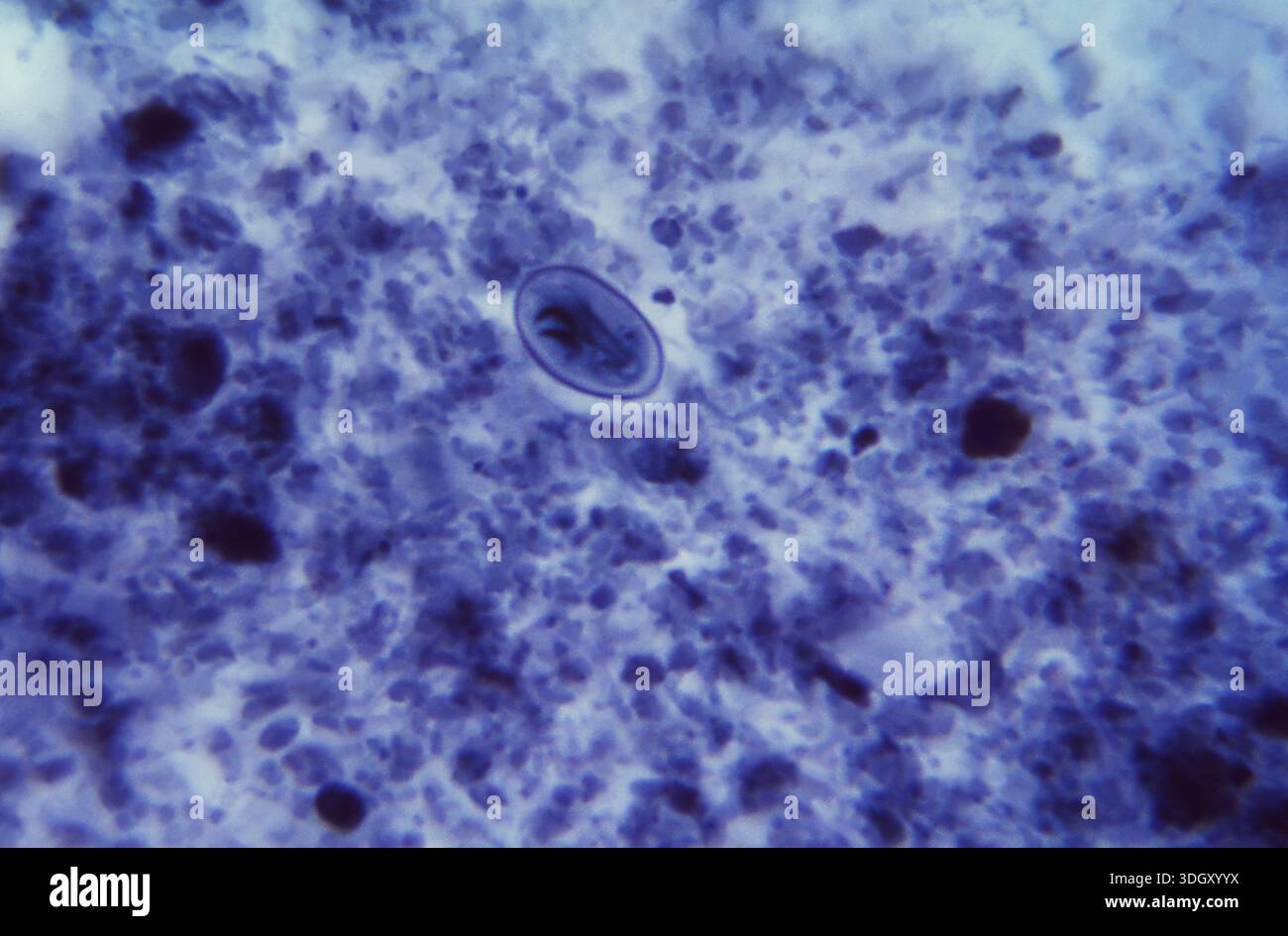 A chorazol black-stained specimen at 900x magnification shows a cyst of ...